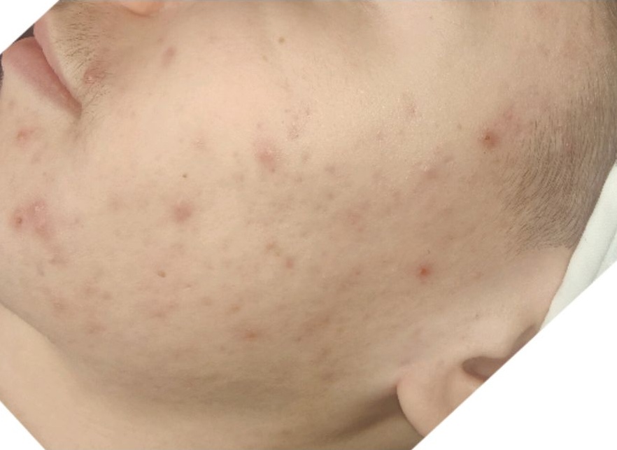 About Hydro - skinbasepro.com