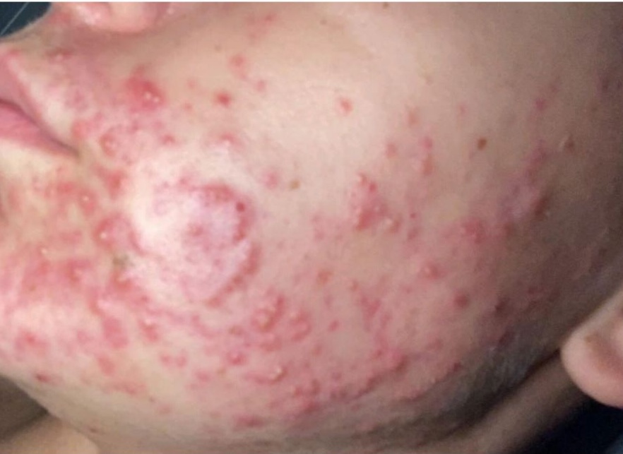 About Hydro - skinbasepro.com