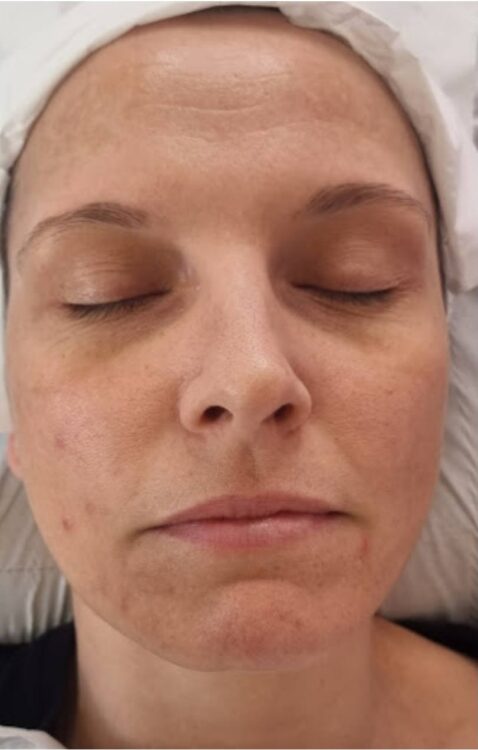 The SkinBase™ MD Hydro Machine - skinbasepro.com