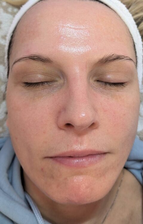 The SkinBase™ MD Hydro Machine - skinbasepro.com