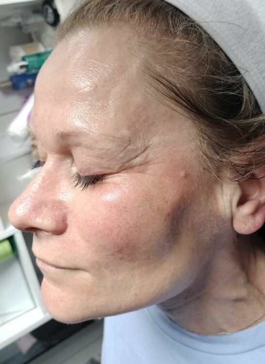 The SkinBase™ MD Hydro Machine - skinbasepro.com