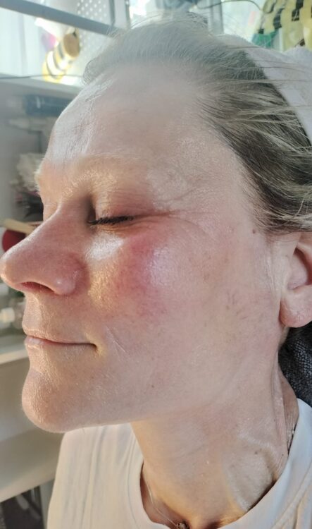 The SkinBase™ MD Hydro Machine - skinbasepro.com