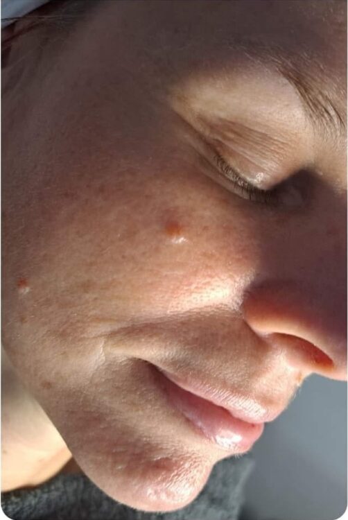 The SkinBase™ MD Hydro Machine - skinbasepro.com